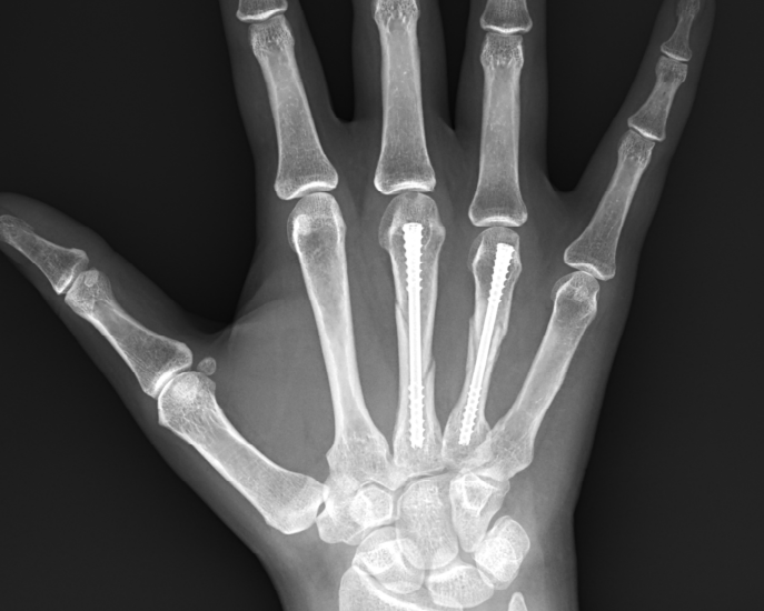 Welcome - Field™ Orthopaedics - Hand Extremity Trauma Care